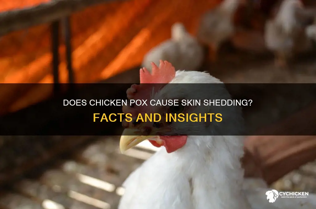 Does Chicken Pox Cause Skin Shedding? Facts And Insights | CyChicken