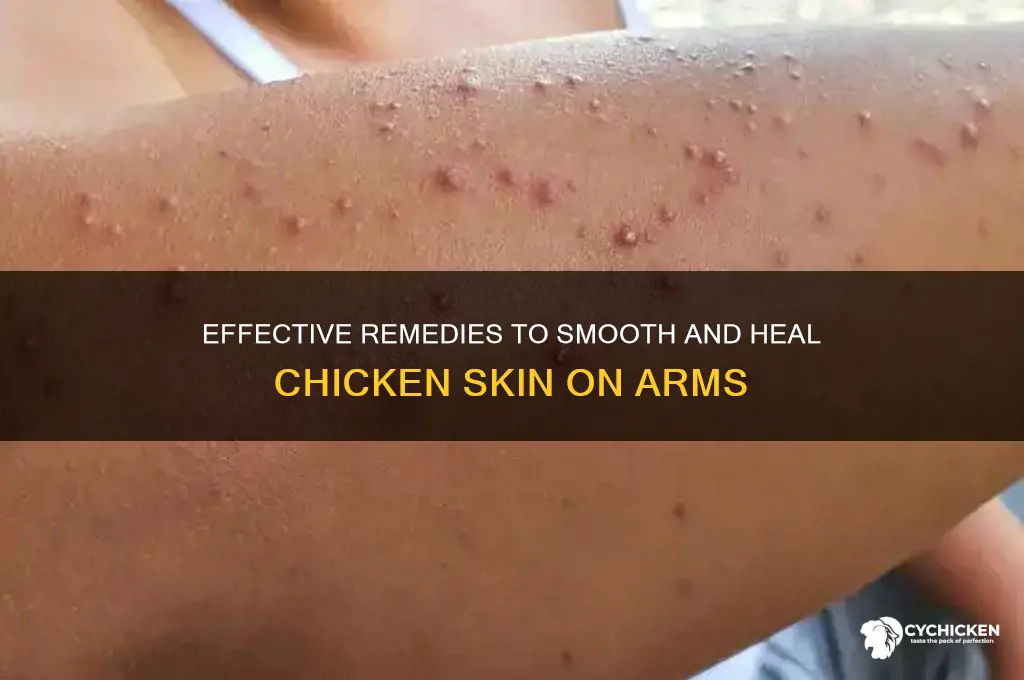 Effective Remedies To Smooth And Heal Chicken Skin On Arms | CyChicken