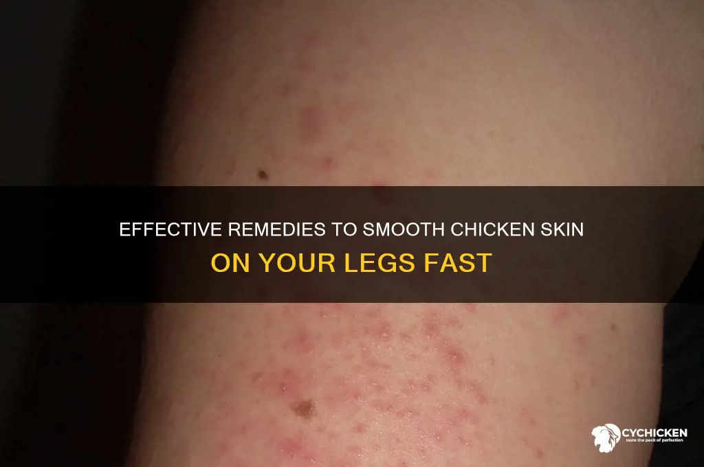 Effective Remedies To Smooth Chicken Skin On Your Legs Fast | CyChicken