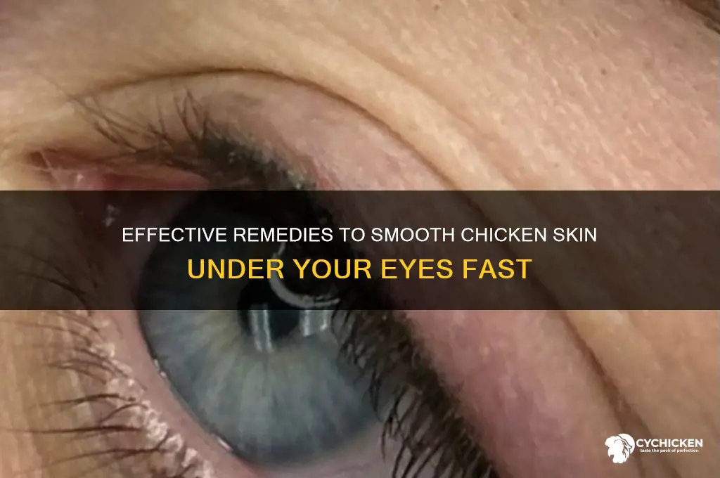 Effective Remedies To Smooth Chicken Skin Under Your Eyes Fast | CyChicken