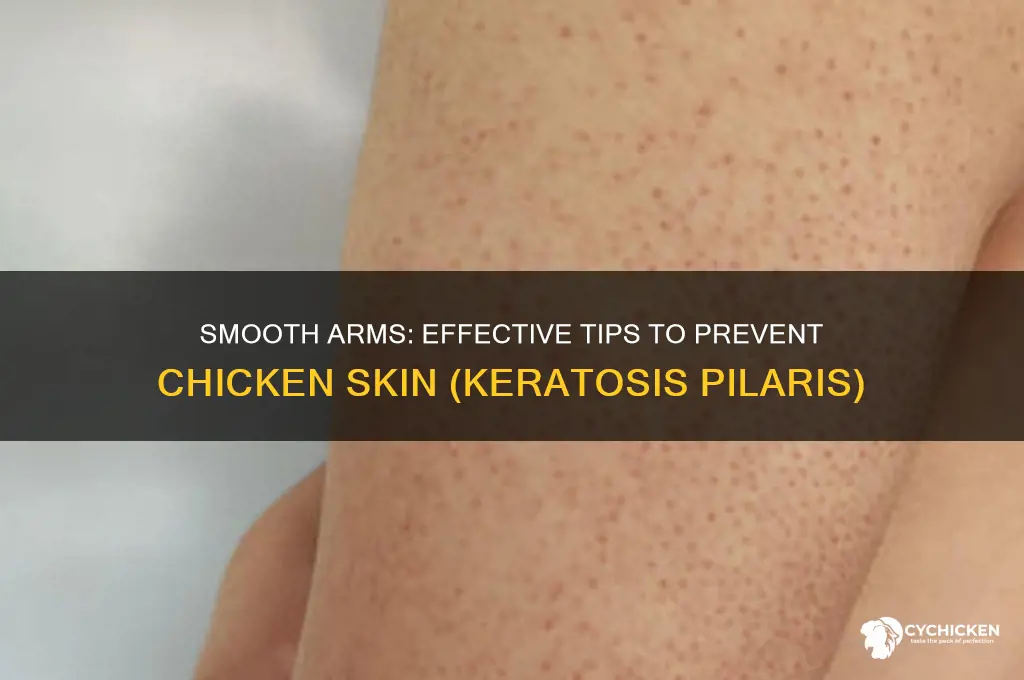 Smooth Arms: Effective Tips To Prevent Chicken Skin (Keratosis Pilaris ...