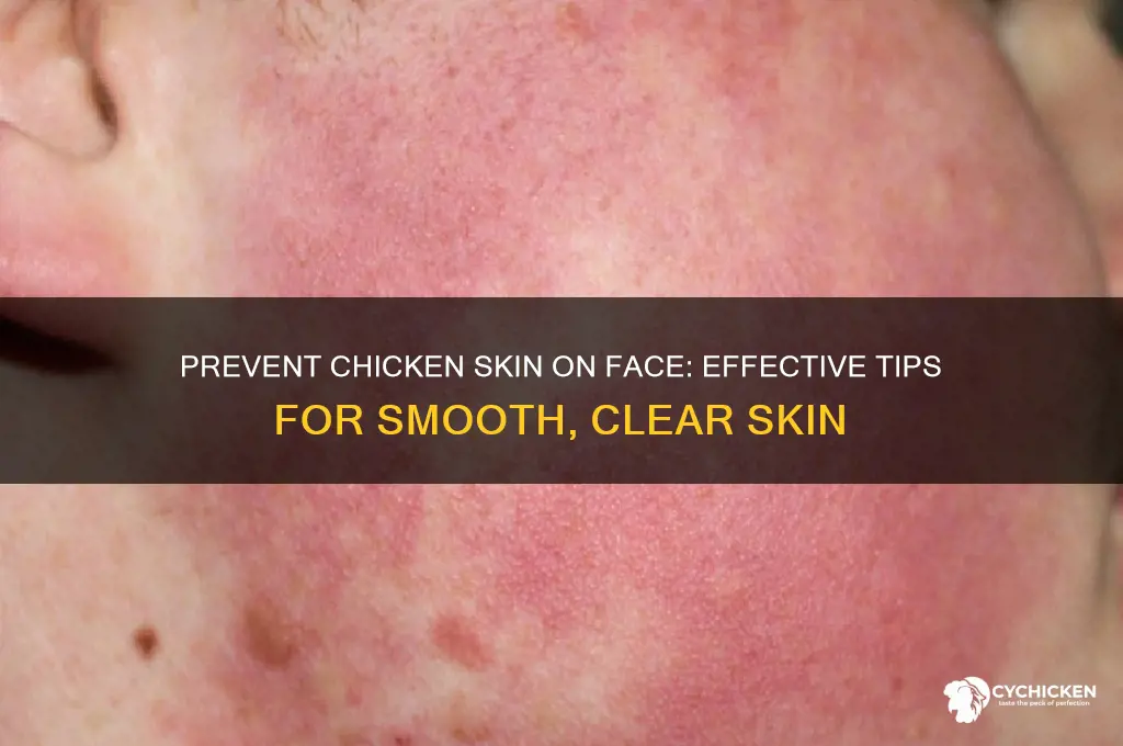 Prevent Chicken Skin On Face: Effective Tips For Smooth, Clear Skin ...