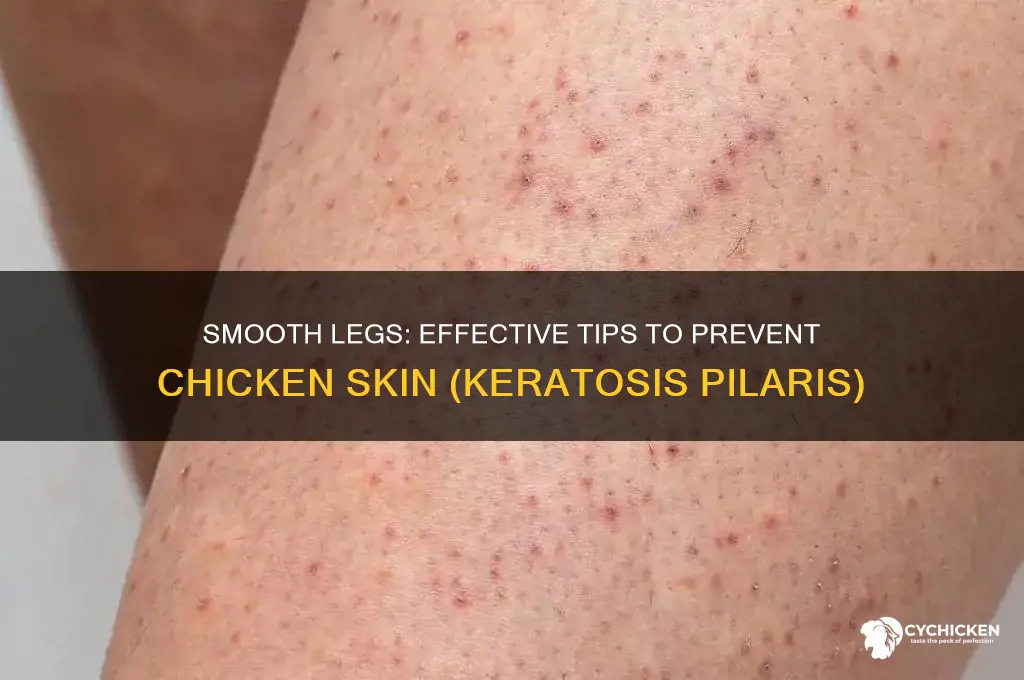 Smooth Legs: Effective Tips To Prevent Chicken Skin (Keratosis Pilaris ...