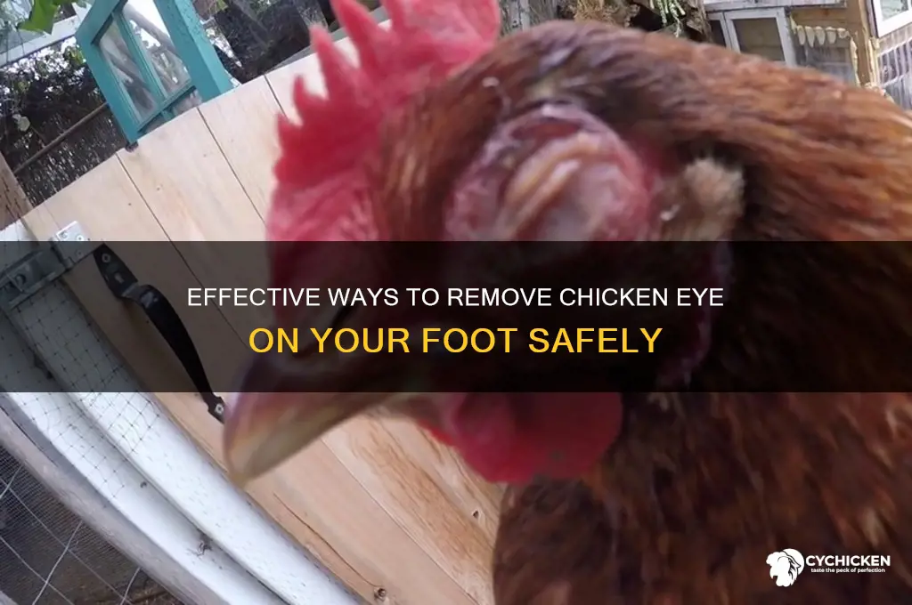 Effective Ways To Remove Chicken Eye On Your Foot Safely | CyChicken