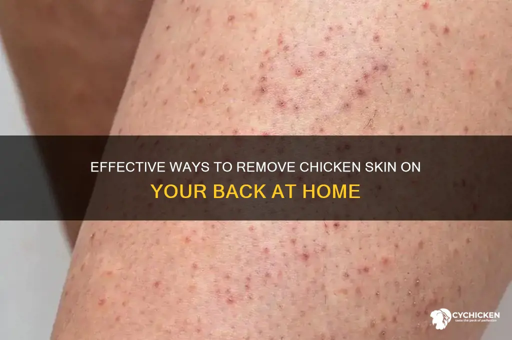 Effective Ways To Remove Chicken Skin On Your Back At Home | CyChicken