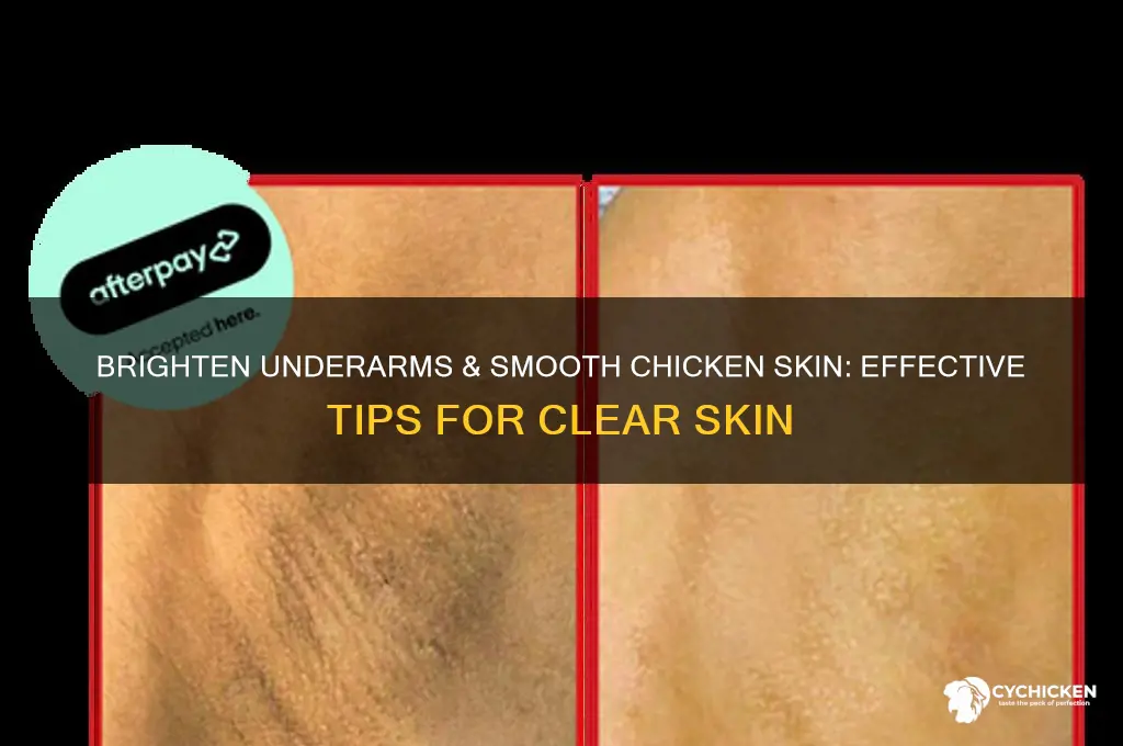 Brighten Underarms & Smooth Chicken Skin: Effective Tips For Clear Skin ...