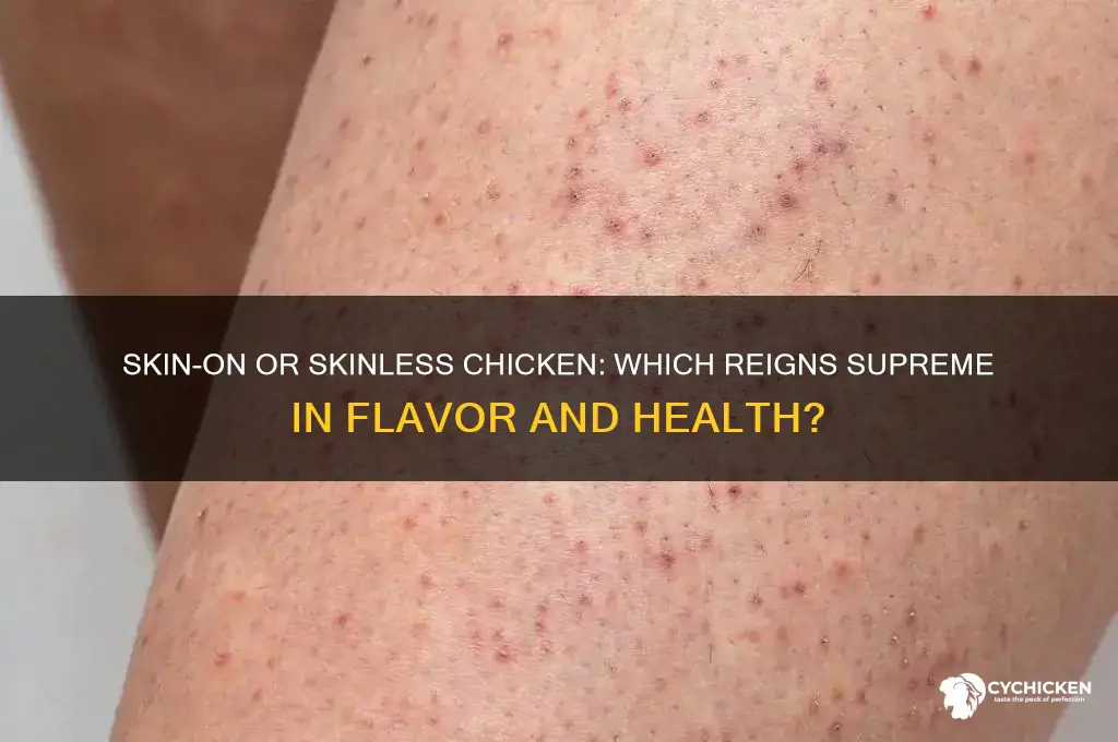 Skin-On Or Skinless Chicken: Which Reigns Supreme In Flavor And Health ...
