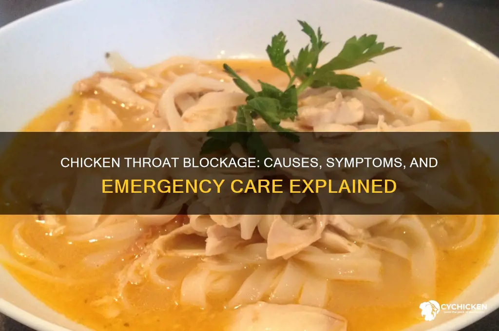 Chicken Throat Blockage: Causes, Symptoms, And Emergency Care Explained ...