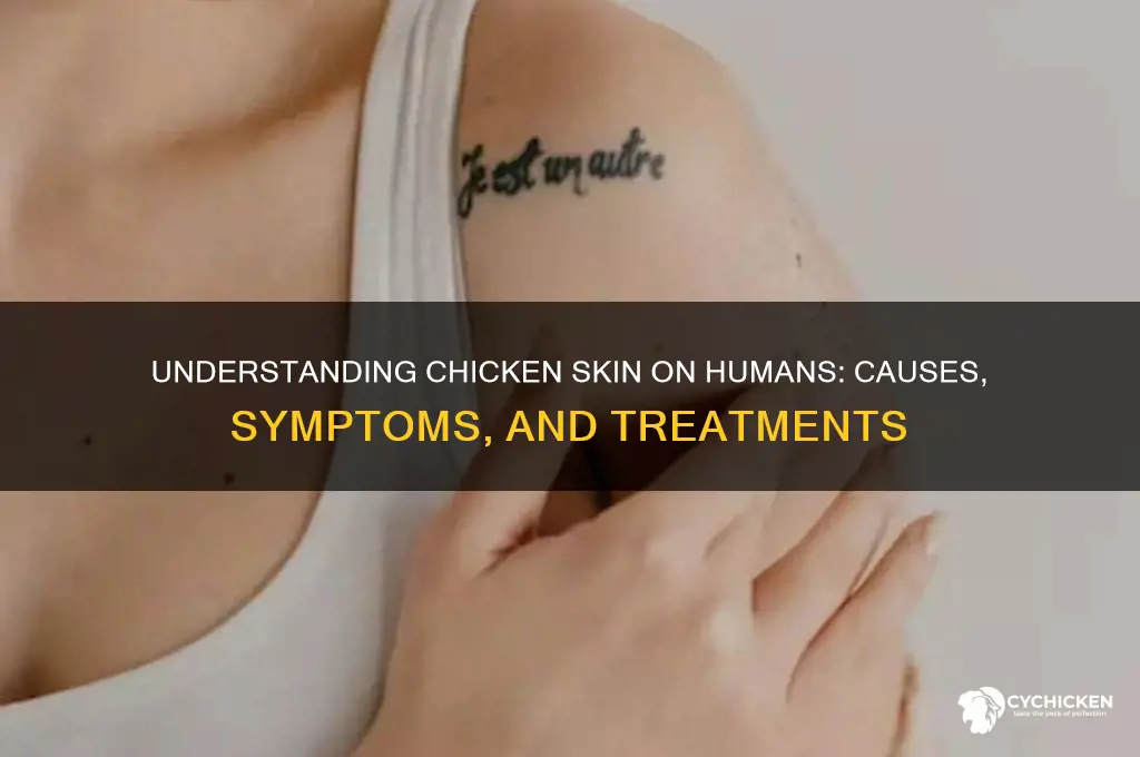 Understanding Chicken Skin On Humans: Causes, Symptoms, And Treatments ...