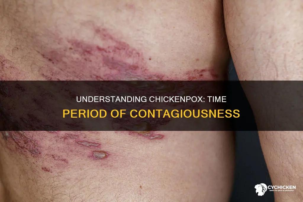 Understanding Chickenpox: Time Period Of Contagiousness | CyChicken