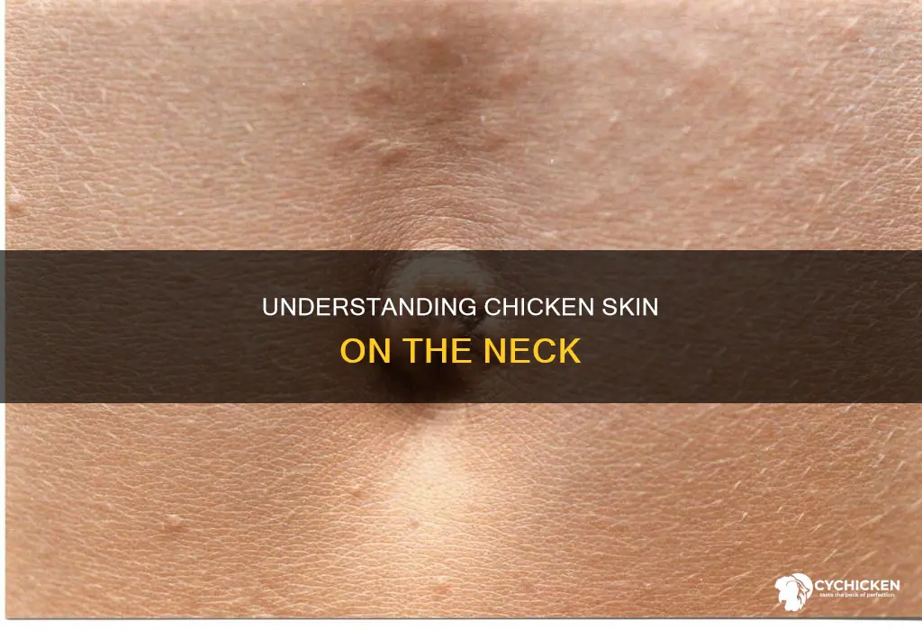 Understanding Chicken Skin On The Neck | CyChicken