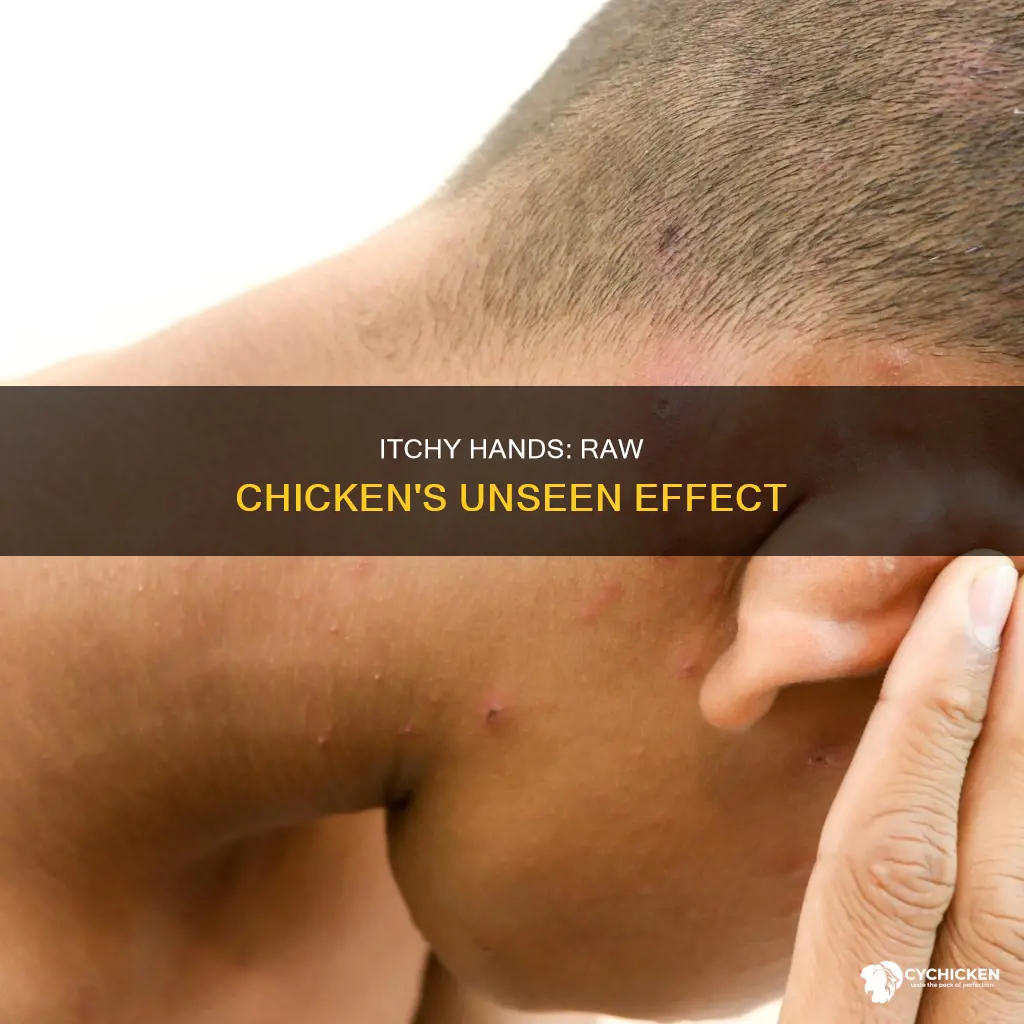 Itchy Hands: Raw Chicken's Unseen Effect | CyChicken