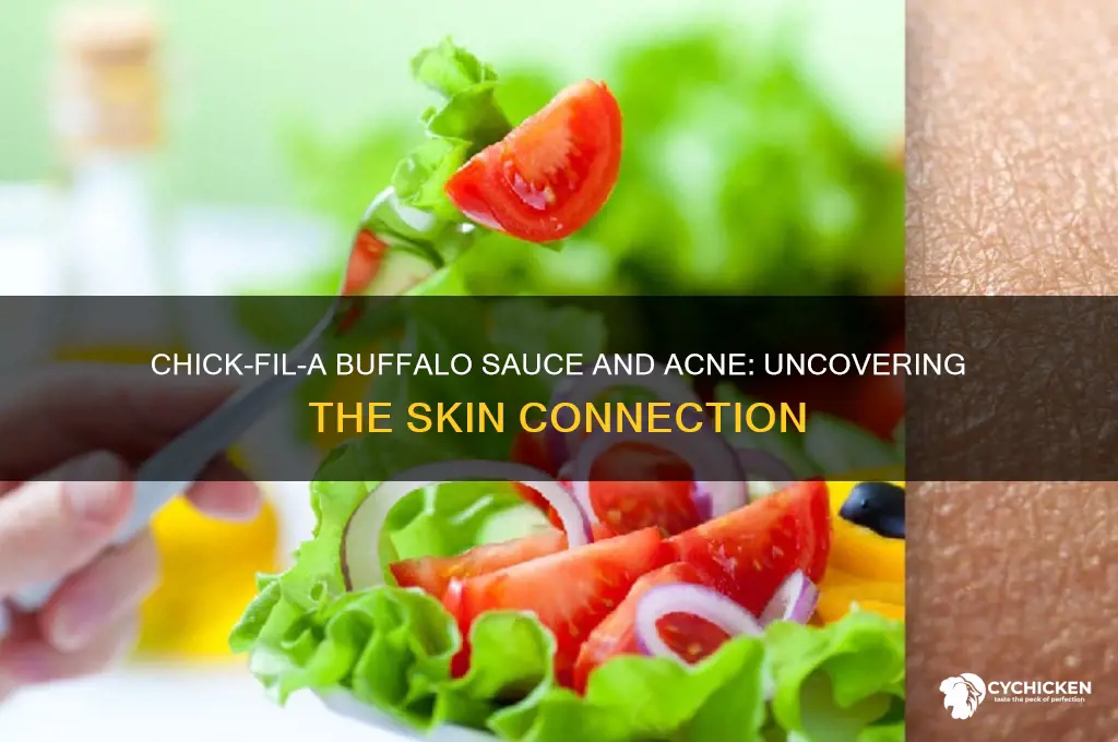 Chick-Fil-A Buffalo Sauce And Acne: Uncovering The Skin Connection ...